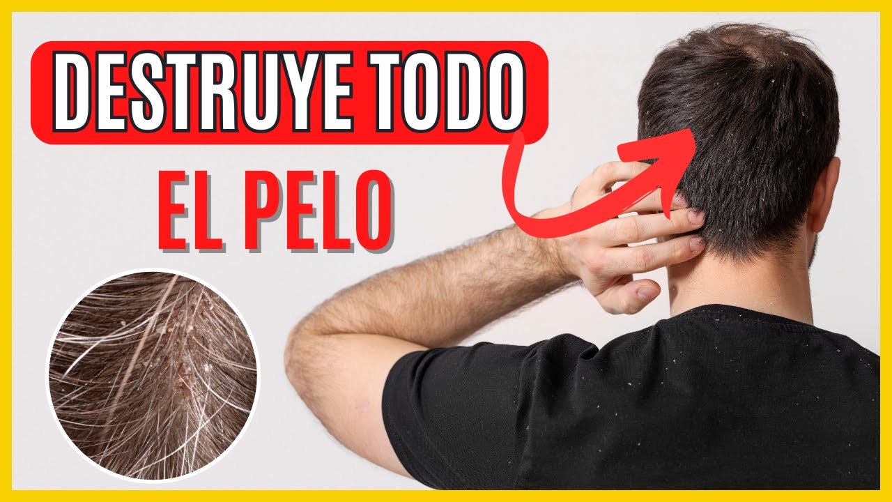 ⚠ Foliculitis CRÓNICA 👉 ¿Qué es? SÍNTOMAS Y TRATAMIENTO - YouTube