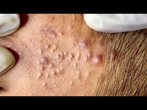 Satisfying video with Chung Vo Spa |173 - YouTube