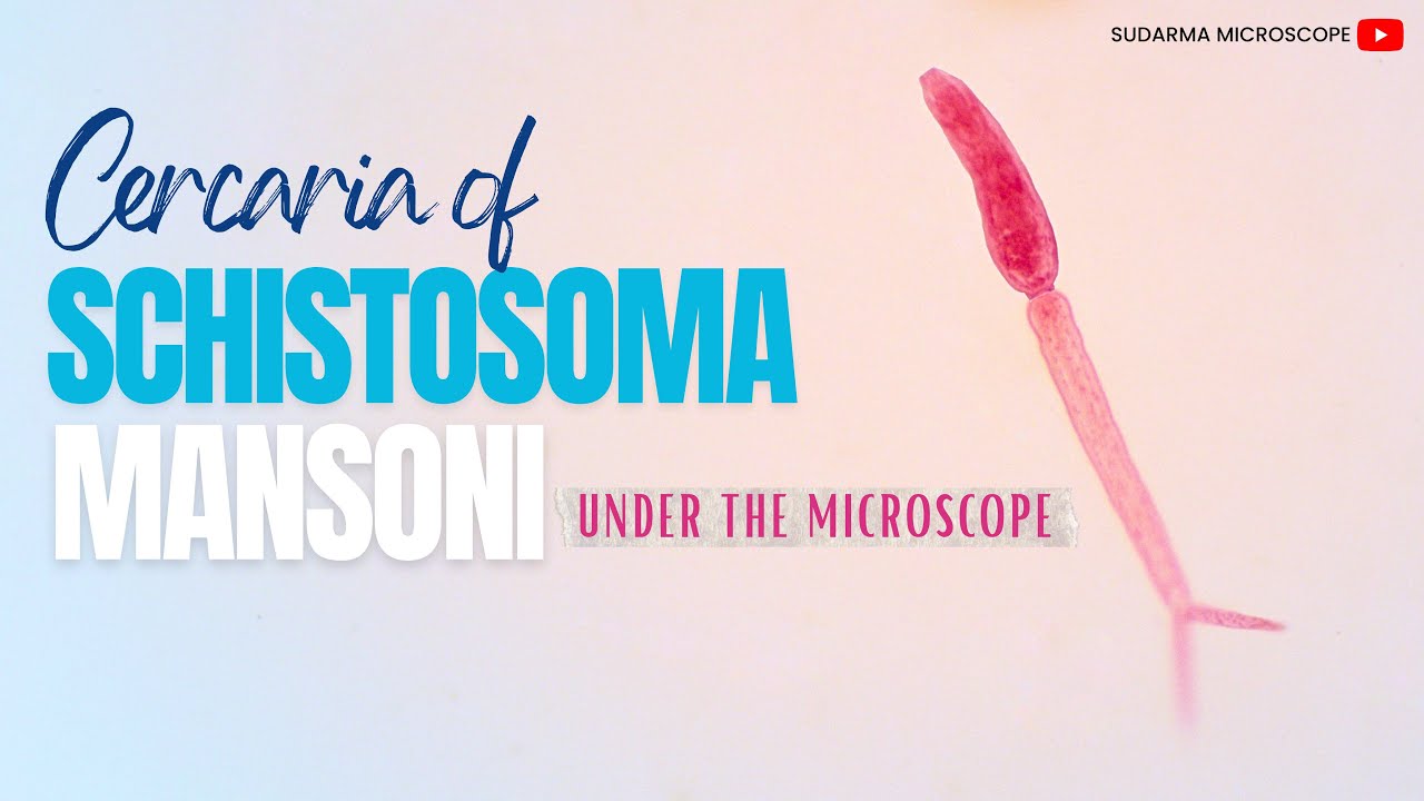 Schistosoma mansoni cercariae under the microscope - YouTube