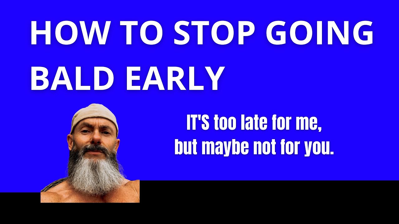 How You Can Stop Going Bald Early - YouTube