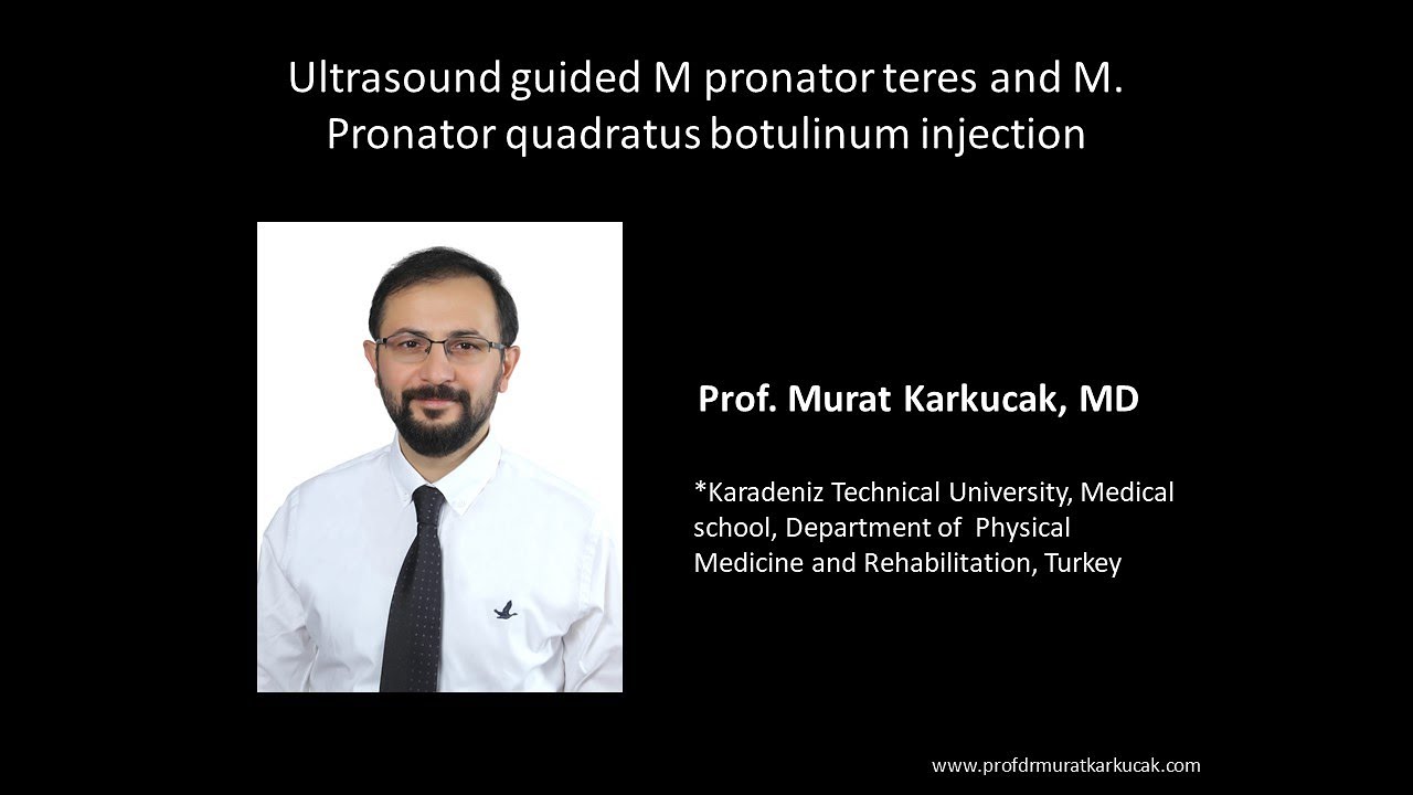 Ultrasound guided M pronator teres and M. Pronator quadratus botulinum ...