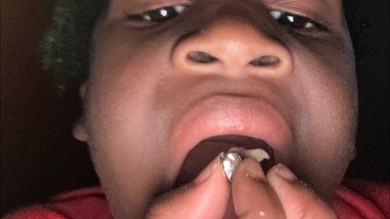 Fake eating my tooth that’s got pulled out prank on brother - YouTube