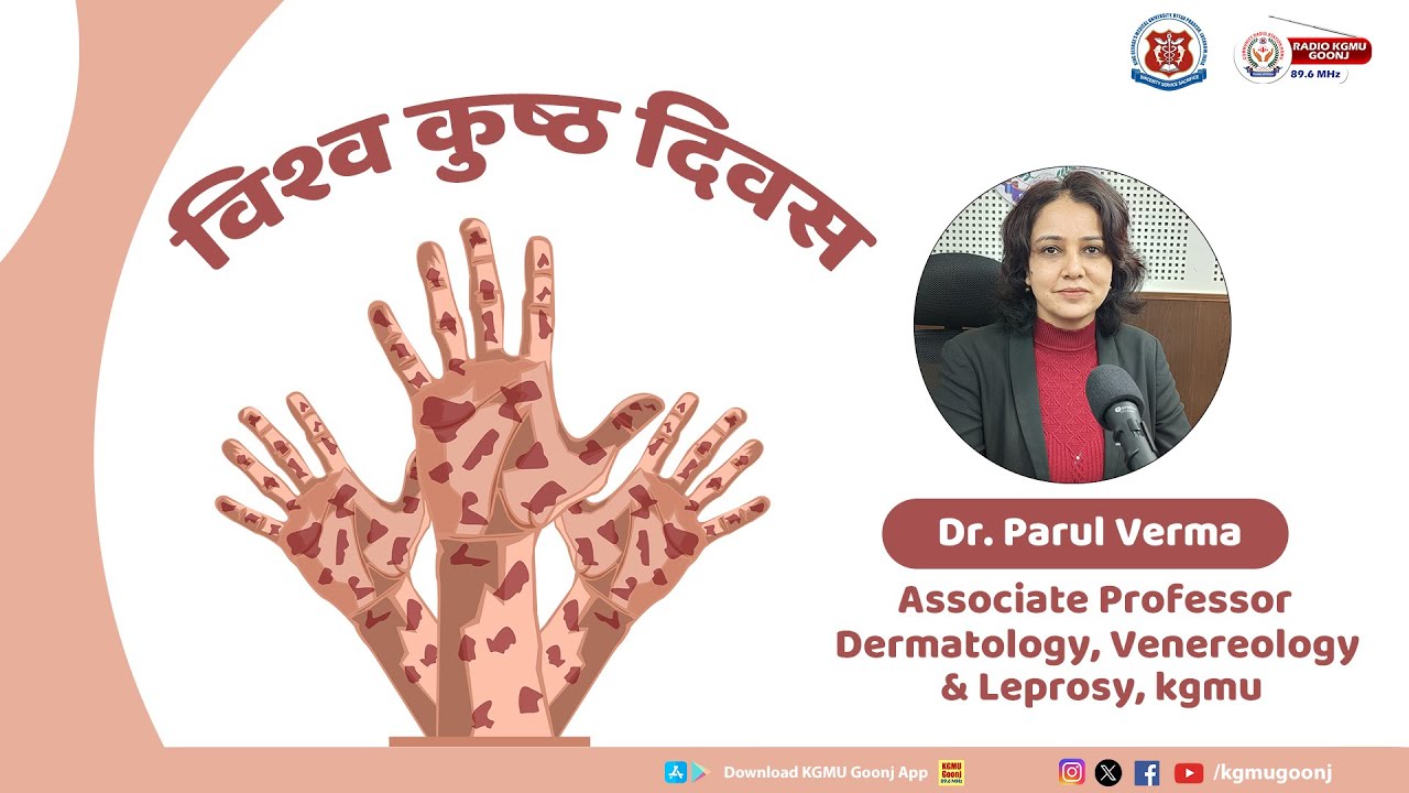 विश्व कुष्ठ दिवस | Dr. Parul Verma | Radio KGMU Goonj 89.6 MHz - YouTube