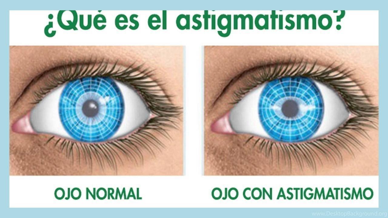 Astigmatismo: Conoce Sus Causas Y Cómo Afecta Tu Visión – ETKTD