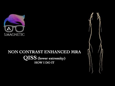 Non Contrast Enhanced MRA QISS (lower extremity) \