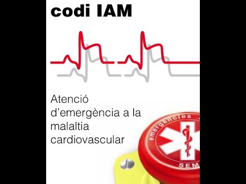 Episodi 23: Codi IAM - YouTube