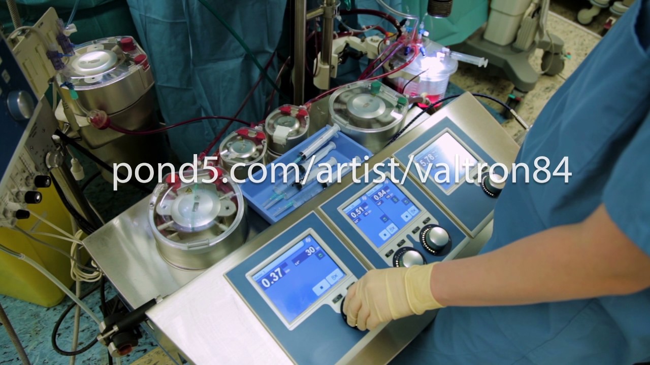 Perfusionist control heart lung machine in operating room - YouTube
