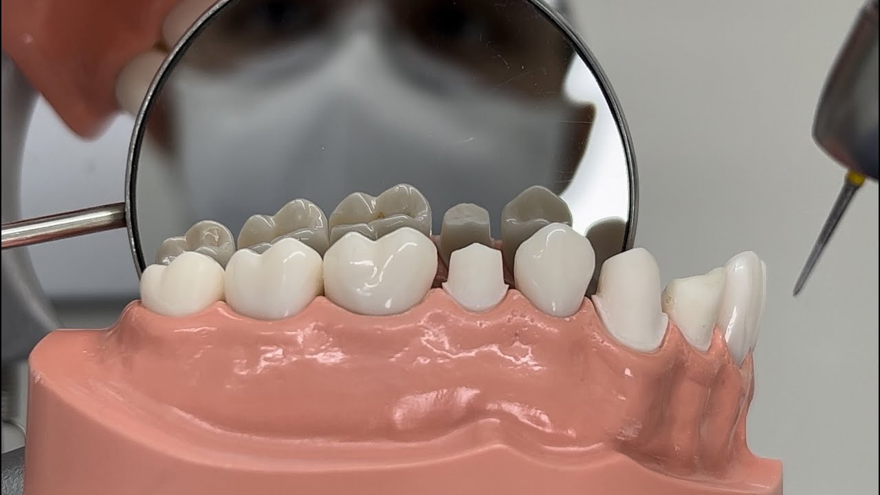 FPD Tooth Preparation (Final Shaping and Polishing) #25 - YouTube