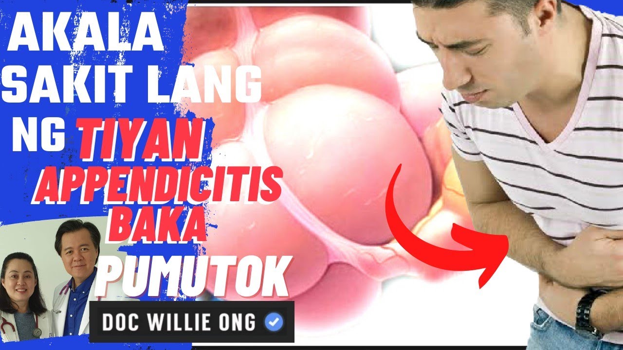Sakit ng Tiyan, Appendicitis: Baka Pumutok! - Payo ni Doc Willie at Doc Liza Ong - YouTube