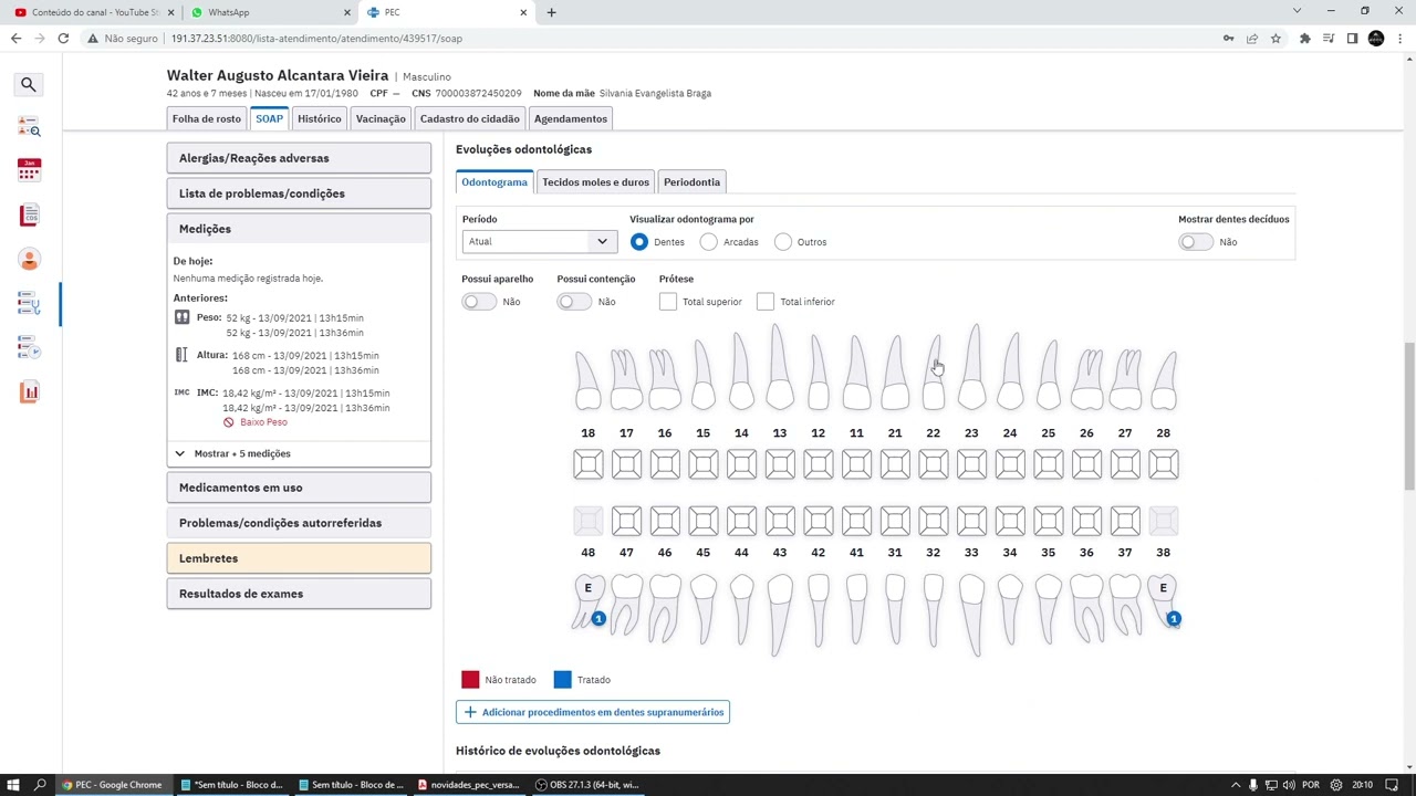 e-SUS APS versão 5.0.7 explicada - Vídeo 4 - Lançando procedimentos ...