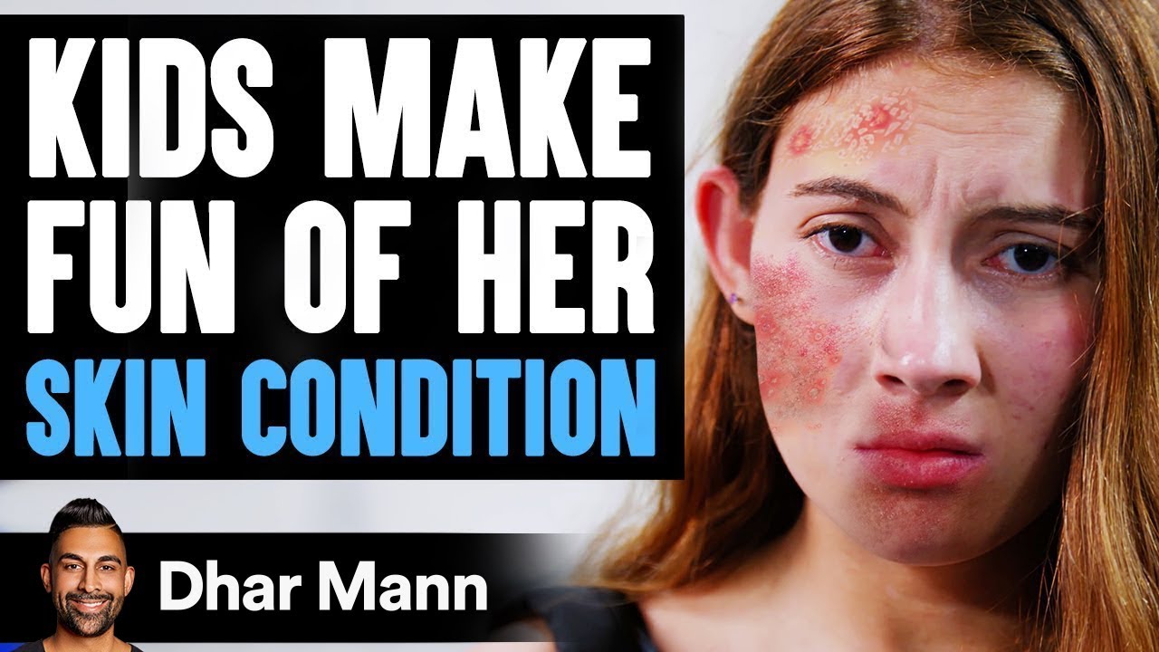 Kids MAKE FUN Of Girl's SKIN CONDITION, What Happens Is Shocking | Dhar ...
