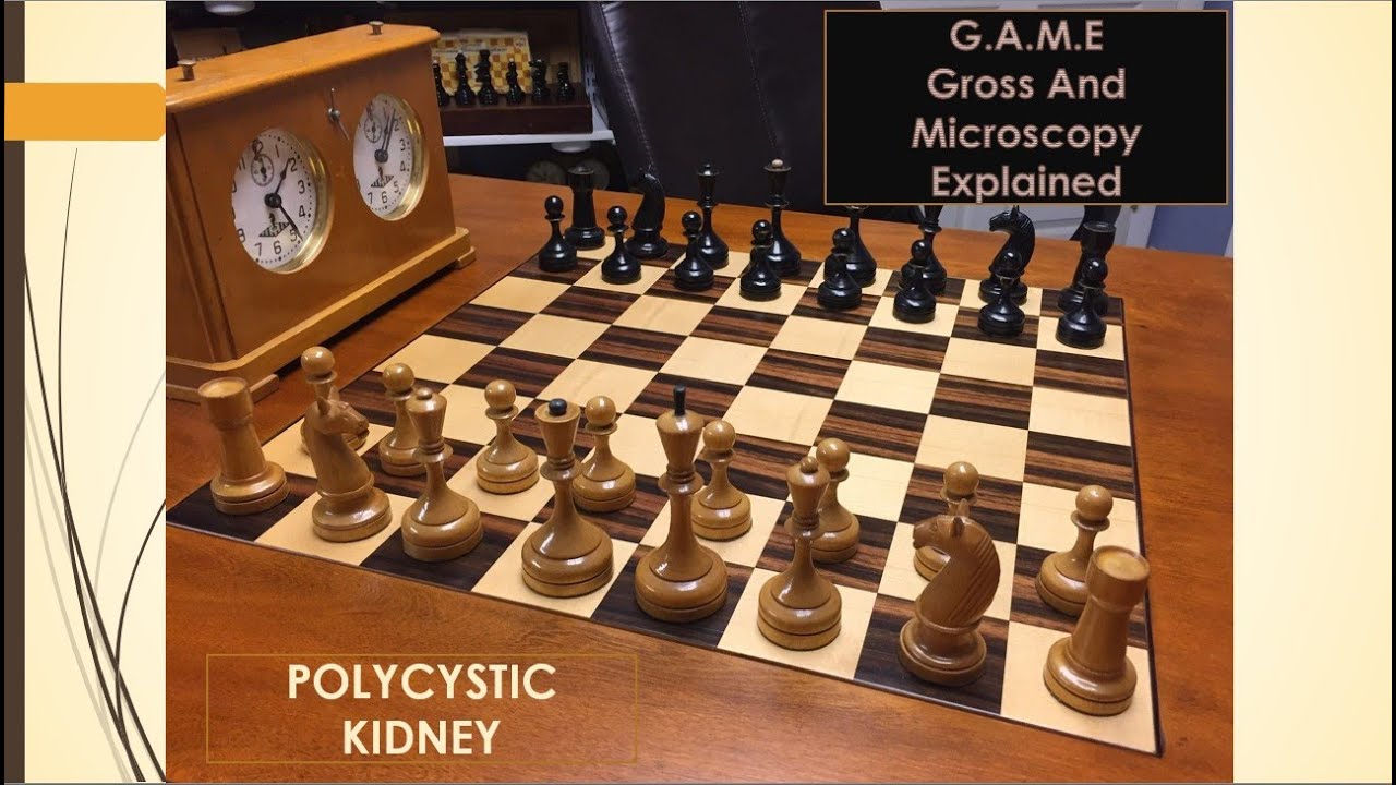 POLYCYSTIC KIDNEY |MBBS PATHOLOGY |RATS [GAME] |DR GSS |EXAM GOING ...