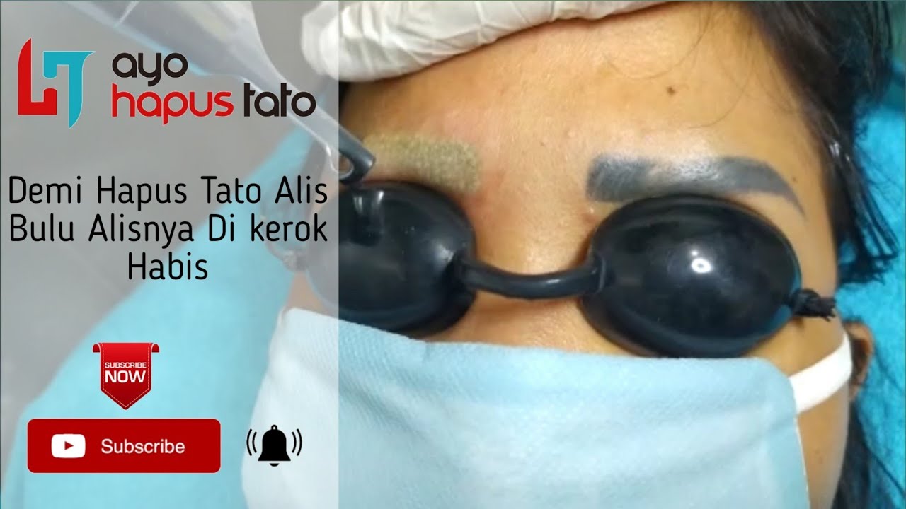 Demi Hapus Tato Alis, Bulu Alisnya Dikerok Habis - YouTube