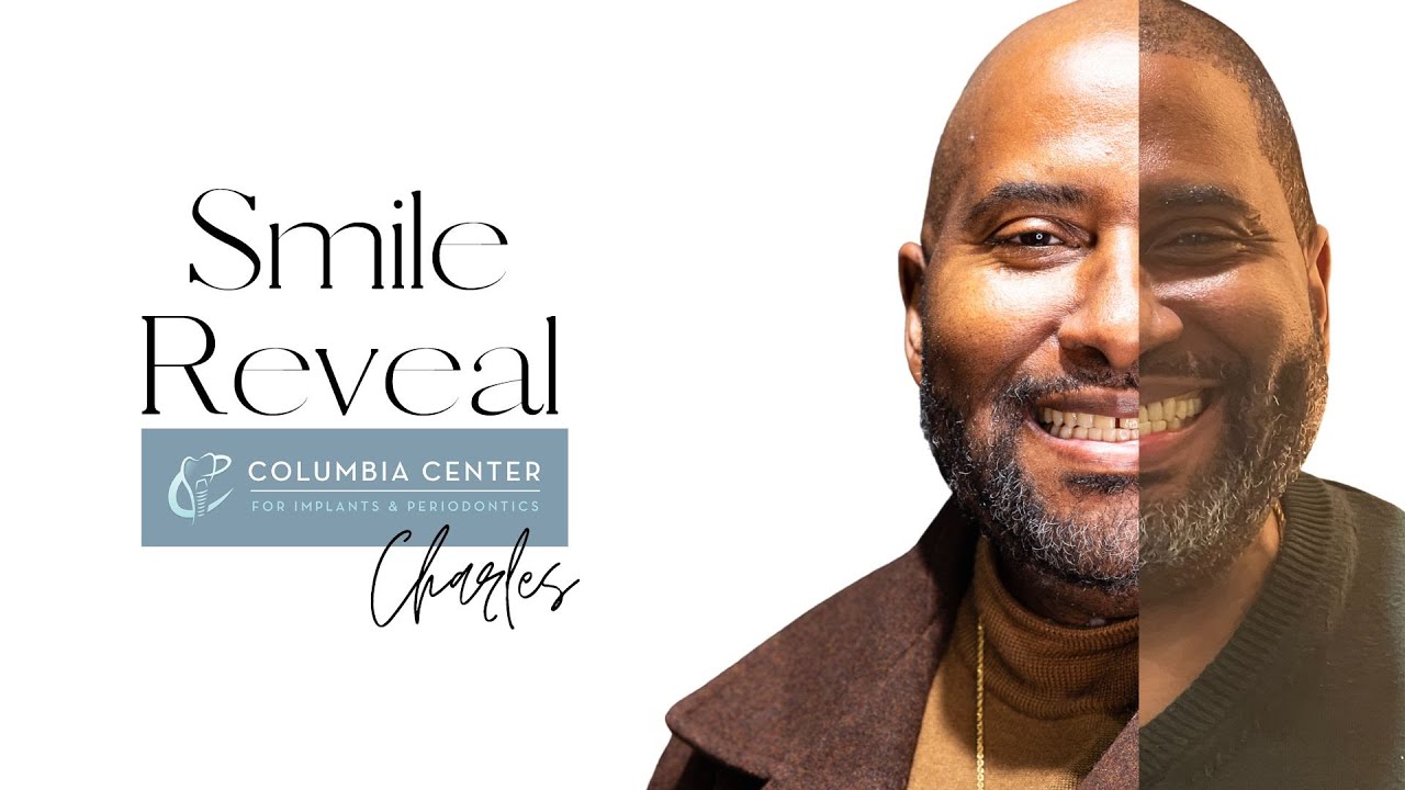 Smile Reveal Video Charles - YouTube