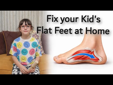 Fix Your Child’s Flat Feet (Simple Home Exercises)