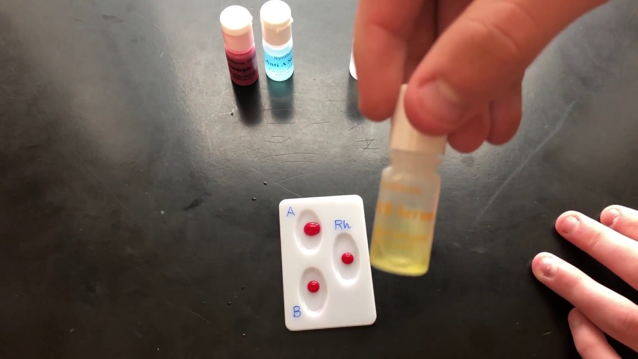 Human Blood Type Test (3) - YouTube
