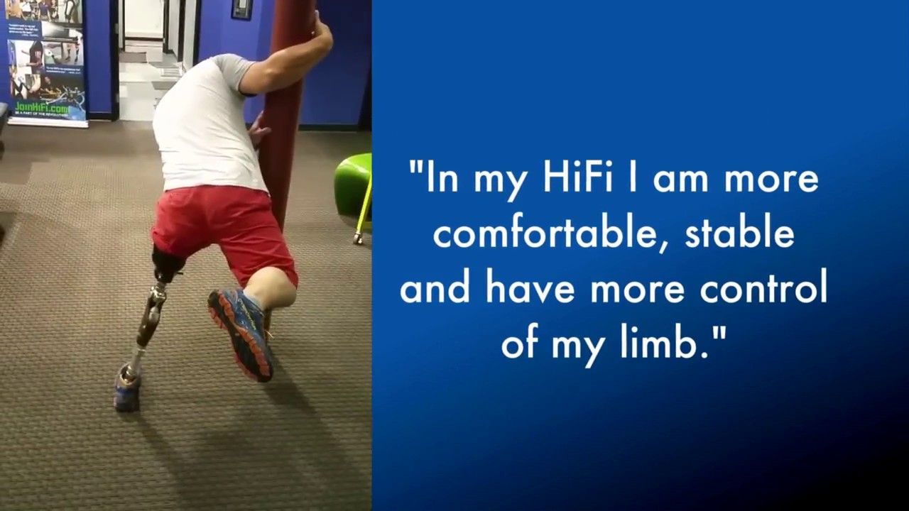 HiFi Above Knee Prosthetic Socket - Kick Your Bucket - YouTube