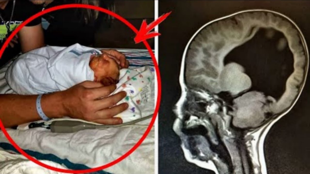 Do you remember The brainless Child? This is how His life turned out ...