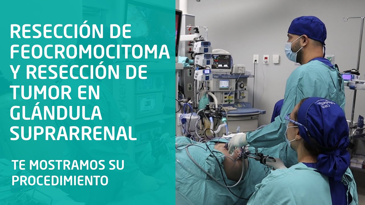 Resección de tumor en glándula suprarrenal - YouTube