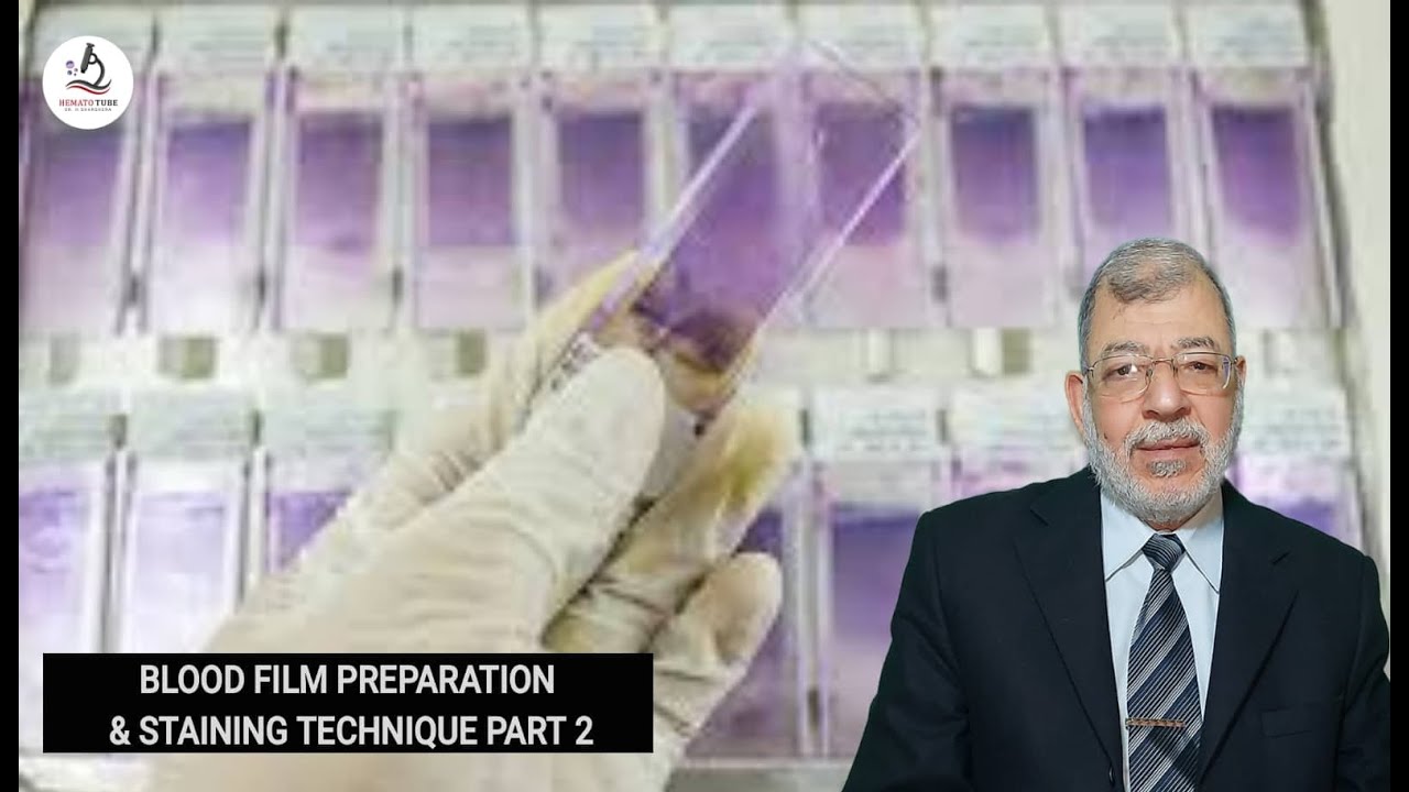 Episode 2: Blood Film Preparation & Staining Technique Part2 - YouTube