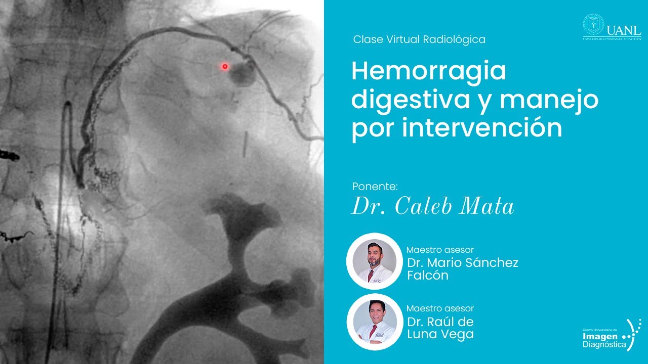Hemorragia Digestiva y manejo por intervención por el Dr. Caleb Mata ...