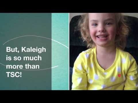 Step Forward to Cure Tuberous Sclerosis Complex 2014