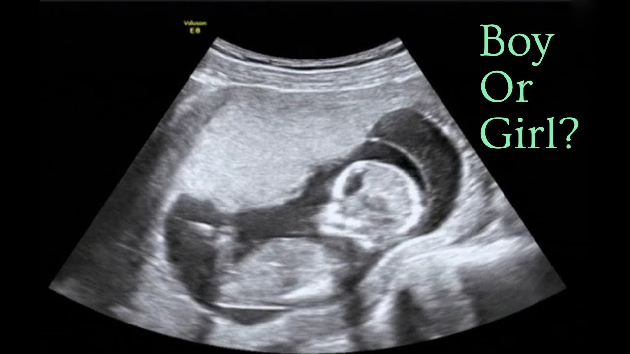 Gender Reveal How I Knew Before The Ultrasound YouTube gender-reveal-how-i-knew-before-the-ultrasound-youtube