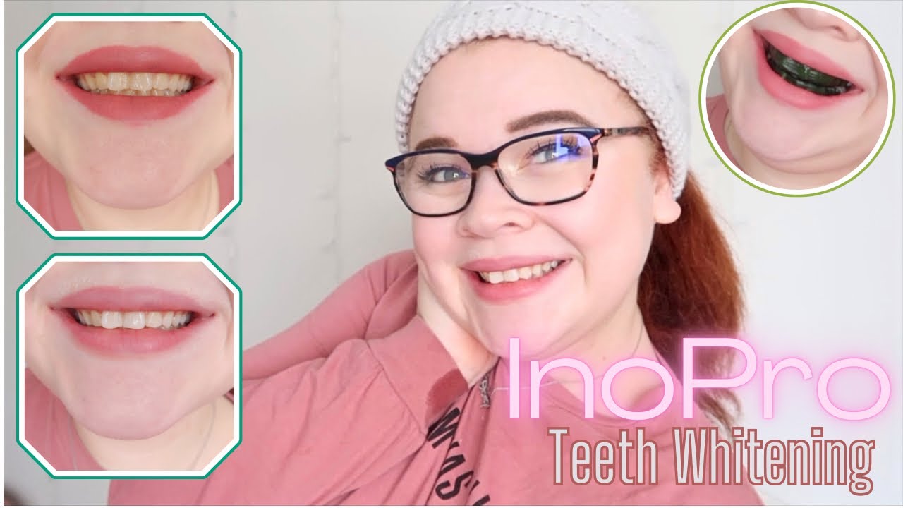 How I Whiten My Teeth Using InoPro! || Does It REALLY Work? - YouTube