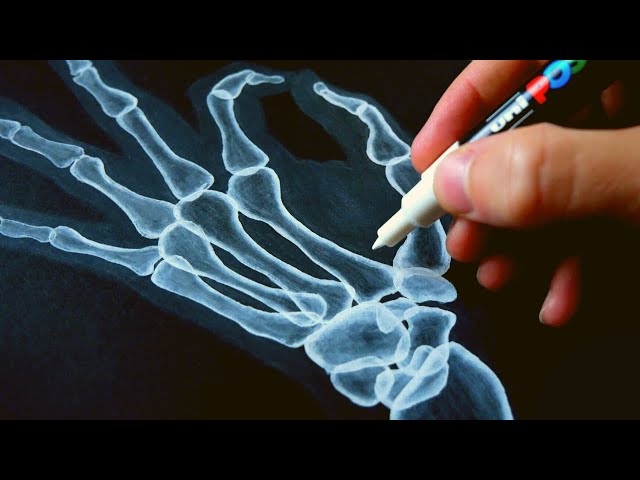 Xray Art Pictures