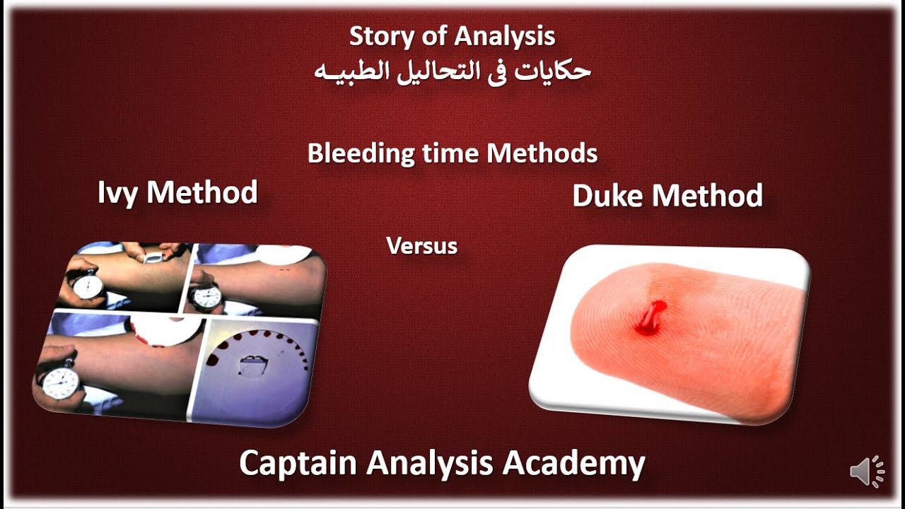الطرق المختلفة لتحليل زمن النزف داخل المعمل E114. Bleeding Time Method ...