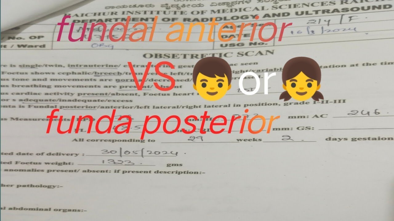 fundal anterior placenta VS funda posterior placenta||girl or boy? # ...