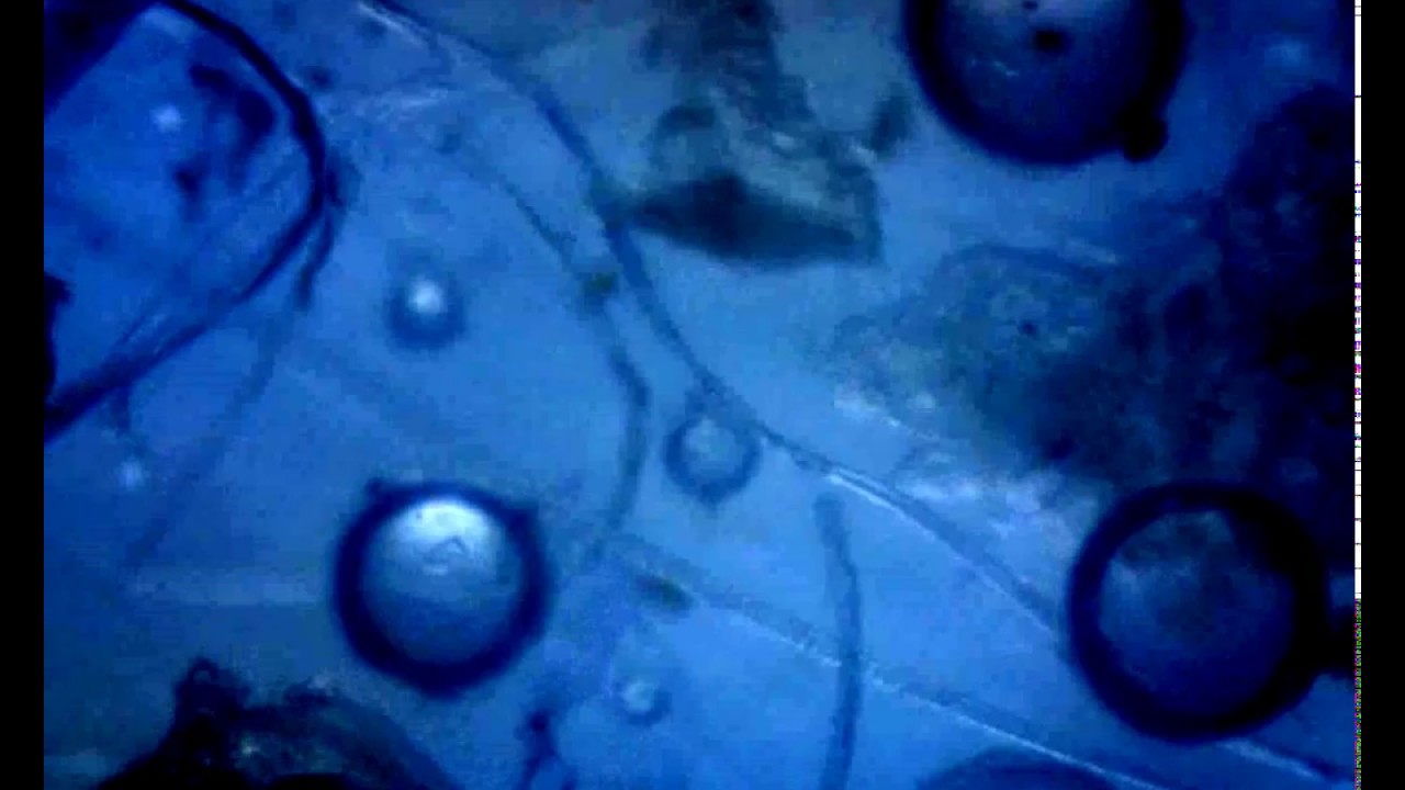 Dust Mite under digital microscope - YouTube