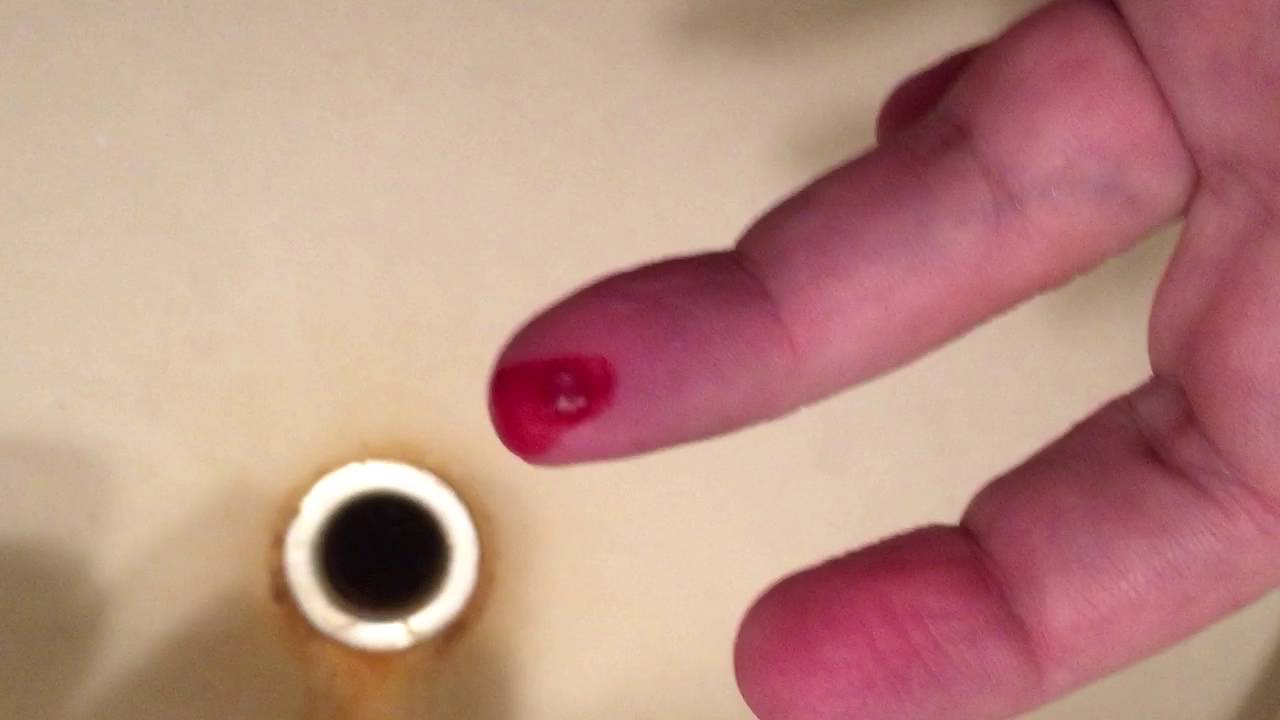 Popping A Small Pimple On My Belly YouTube popping-a-small-pimple-on-my-belly-youtube