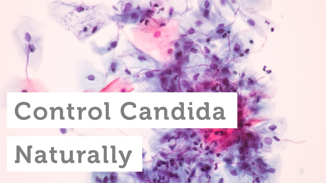 What to Do About a Candida or Yeast Overgrowth - YouTube