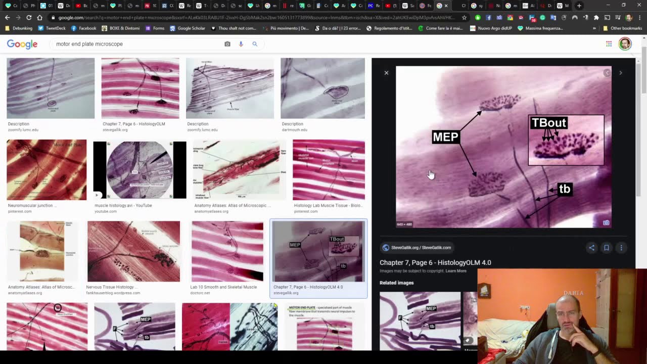Fisiologia Muscolare - Placca Motrice (ed altro) EXTRA - YouTube