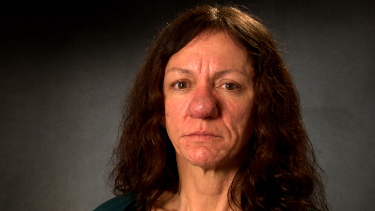 My Nose Destroyed My Life…Until I Came On The Drs; Inside The Mind Of A ...