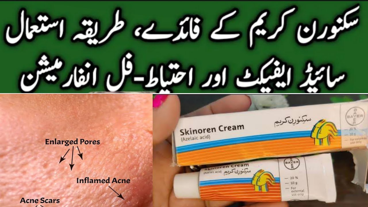 Skinoren Cream Uses and Side Effects| How to Use Skinoren Cream| Get ...