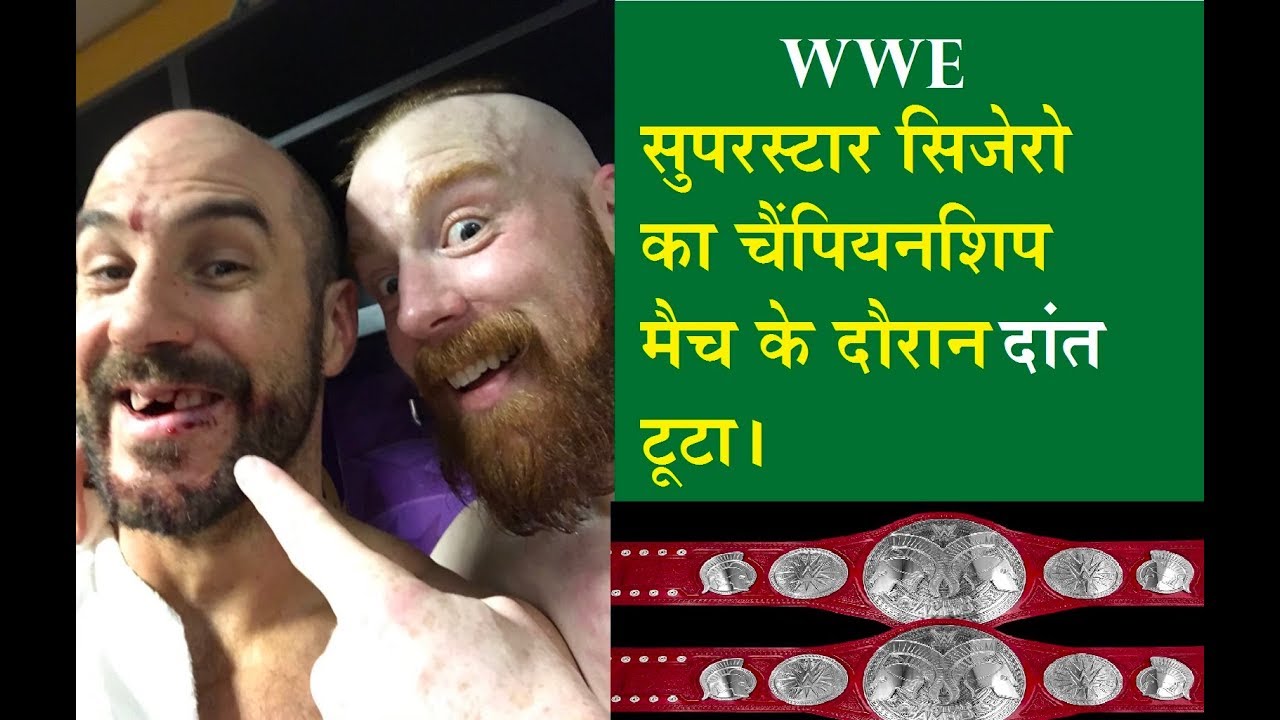 Cesaro Loses Teeth During Match at No Mercy 2017। Cesaro Loses Front ...