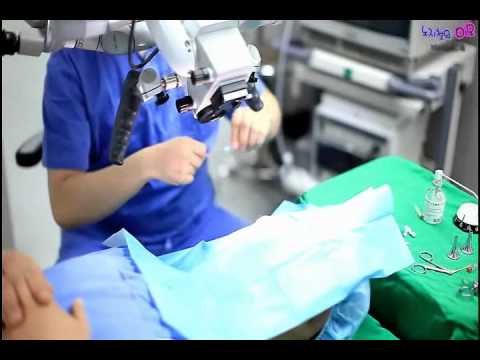 Intratympanic injection - YouTube