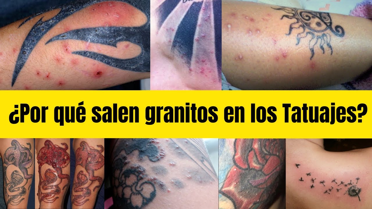 ¿Por qué salen granitos en el tatuaje? /Protección y cuidados / Golden ...