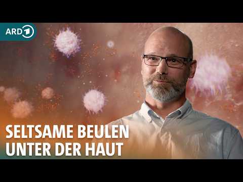 Abenteuer Diagnose: Schmerzen, Schwellungen, seltsame Knubbel - was passiert mit Markus Hand?