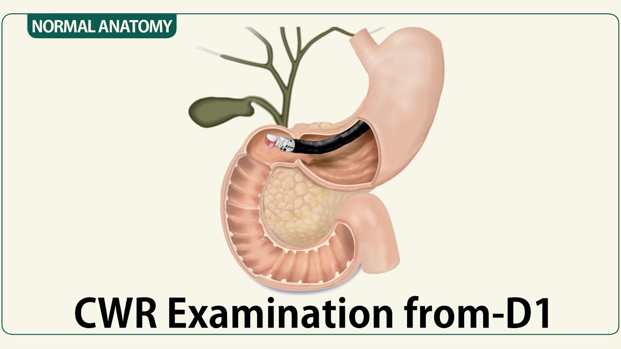 CWR Examination from D1 - YouTube