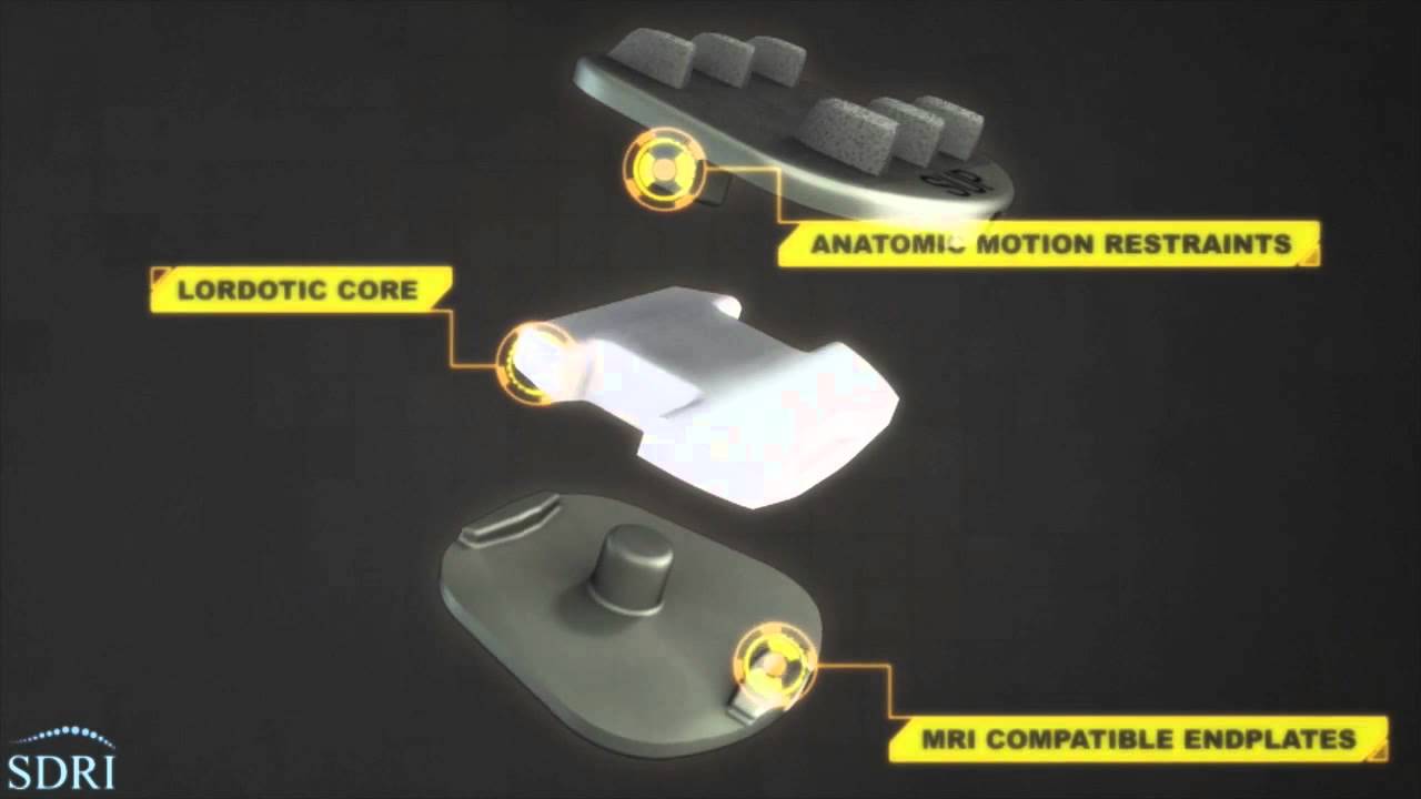 Medical Video & Motion Graphics : Infuse Medical - YouTube