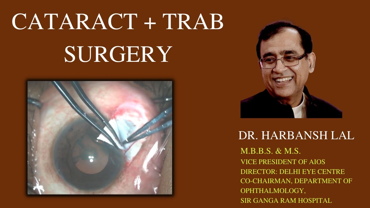 Cataract + Trab Eye Surgery at Delhi Eye Centre, Best Cataract Surgeon ...