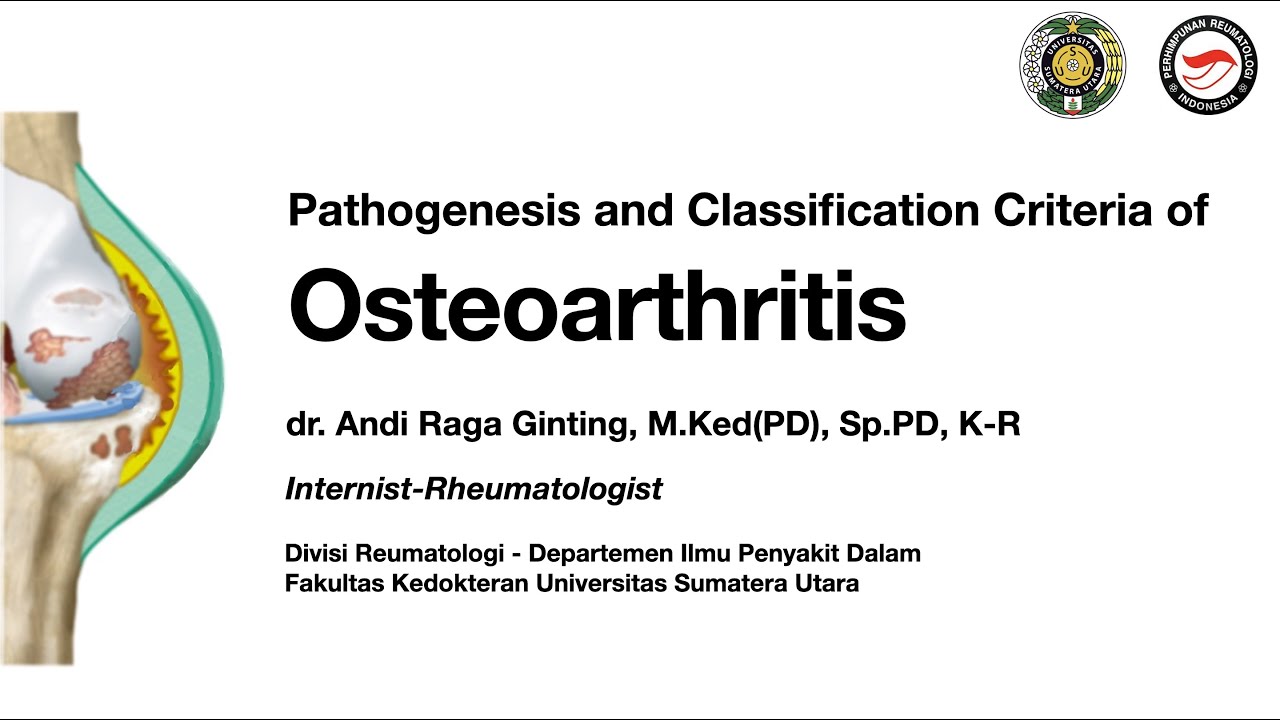 Pathogenesis and Classification Criteria of Osteoarthritis - YouTube