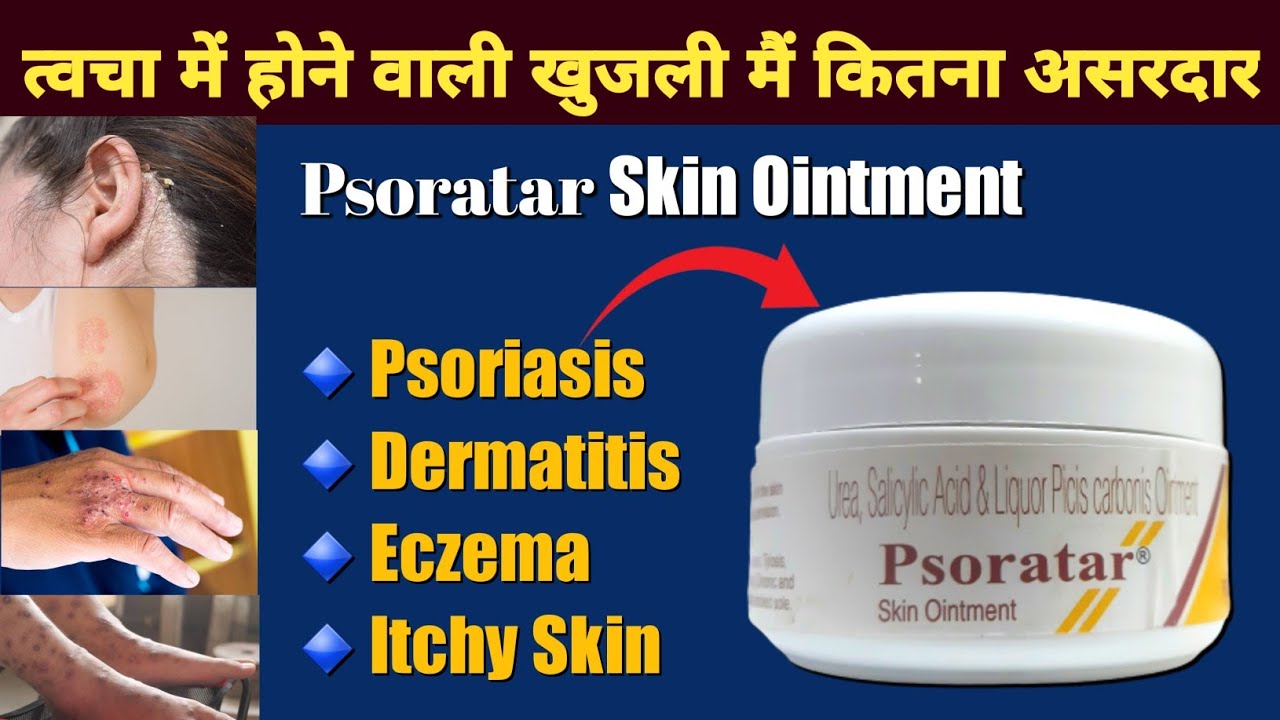 Psoratar Skin Ointment Uses For Psoriasis Treatment | Urea Salicylic ...