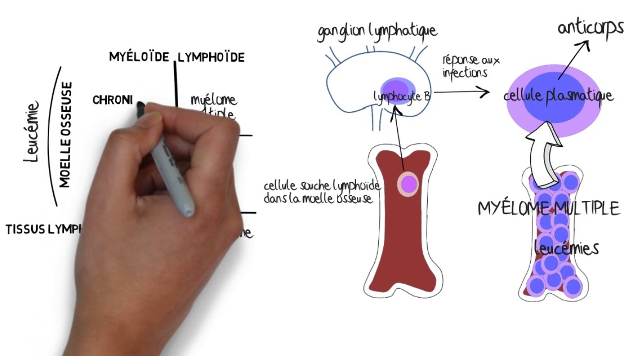 Comprendre le myélome multiple - YouTube
