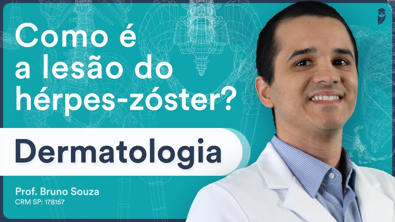 Como é a lesão do hérpes zóster - Dermatologia Residência Médica e ...