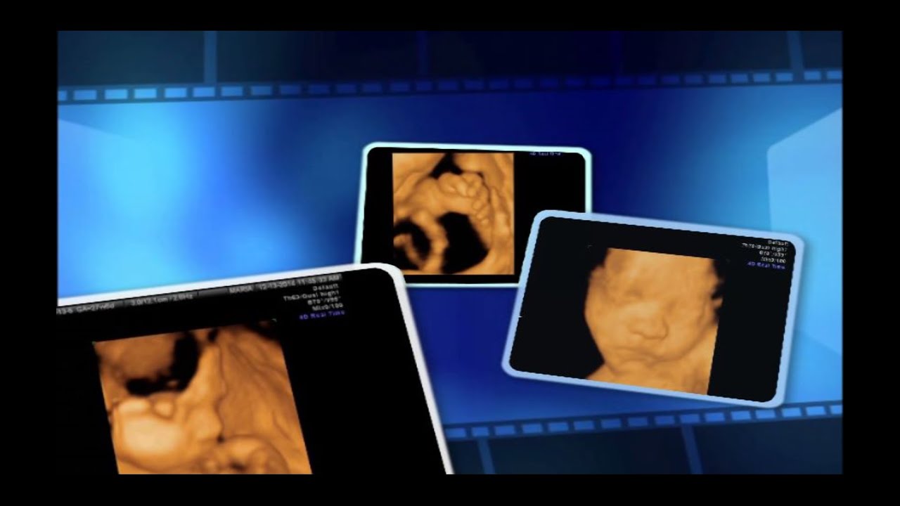 3D/4D Ultrasound - Select Scenes - Baby JP - 27 Weeks 4 Days - YouTube