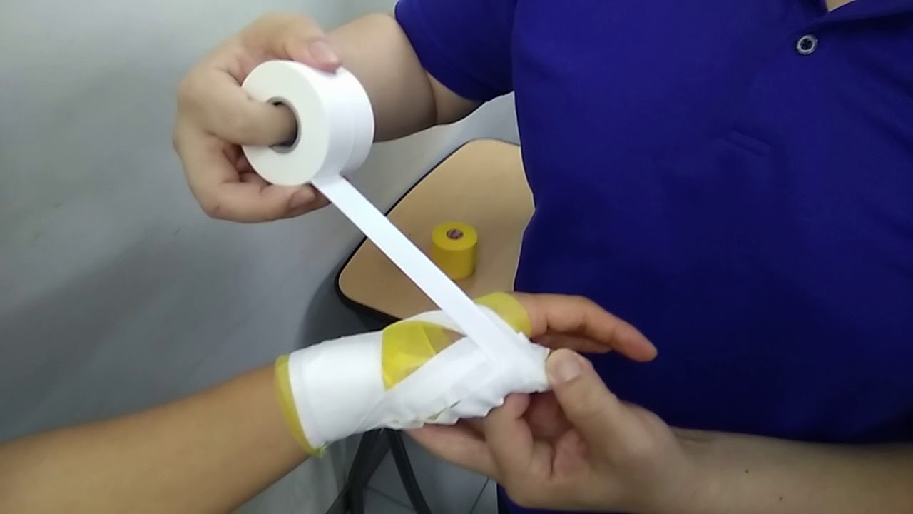국민대학교 체육과 스포츠건강재활전공 thumb spica taping - YouTube